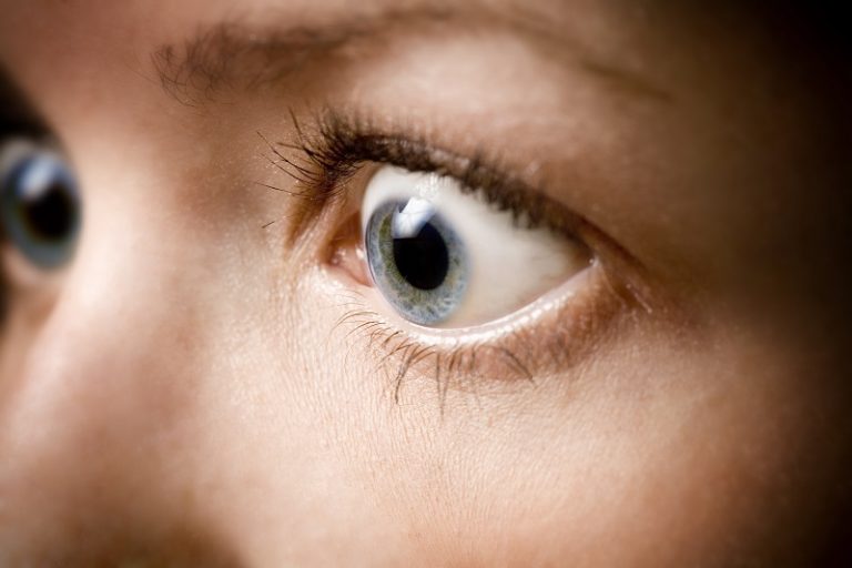 Do I Have Proptosis? - Grosinger, Spigelman & Grey