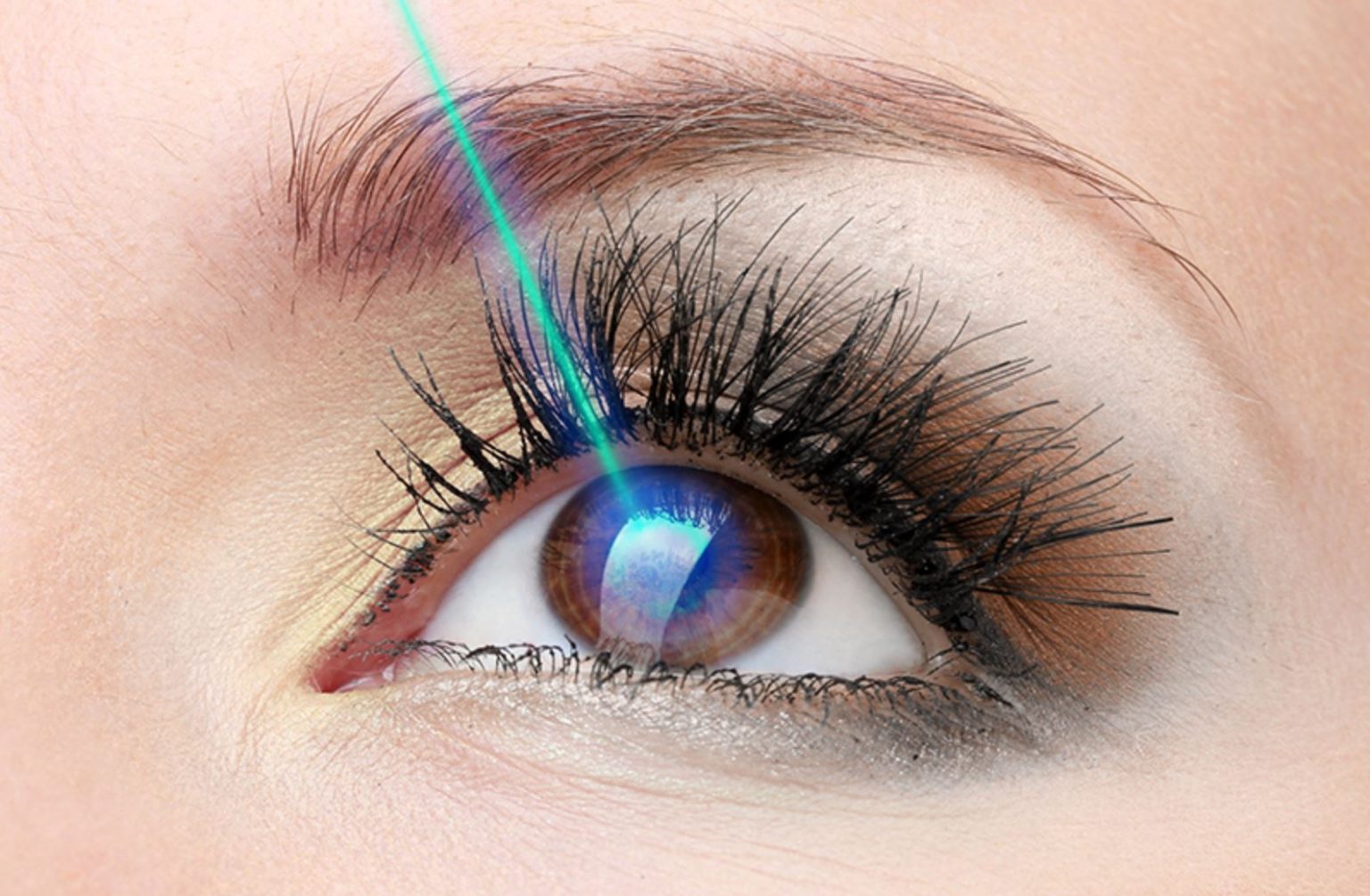 VIVITY® IOL FROM ALCON - Grosinger, Spigelman & Grey